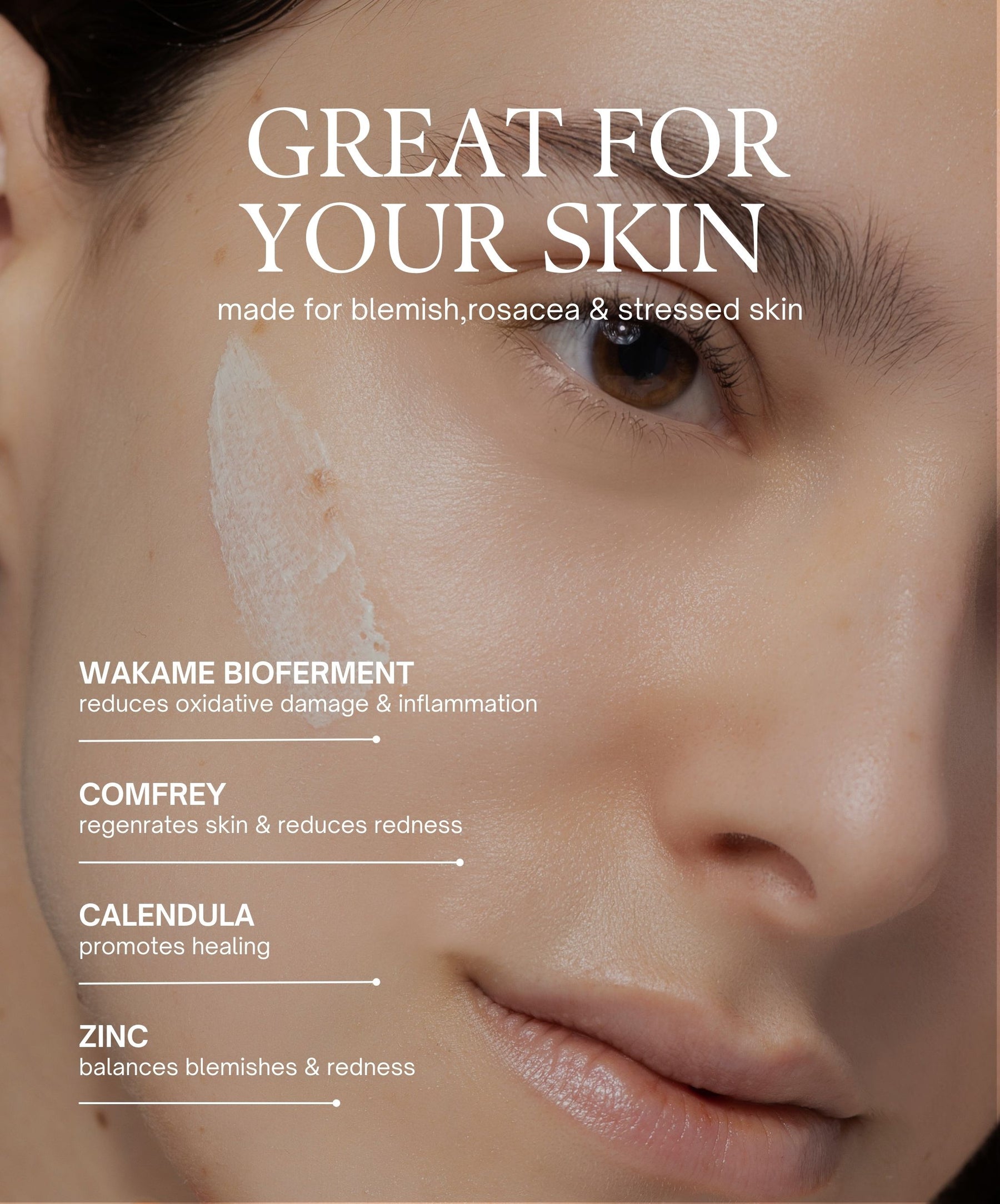 Redness Rescue Cream | Redness Reducing Moisturizer for Rosacea