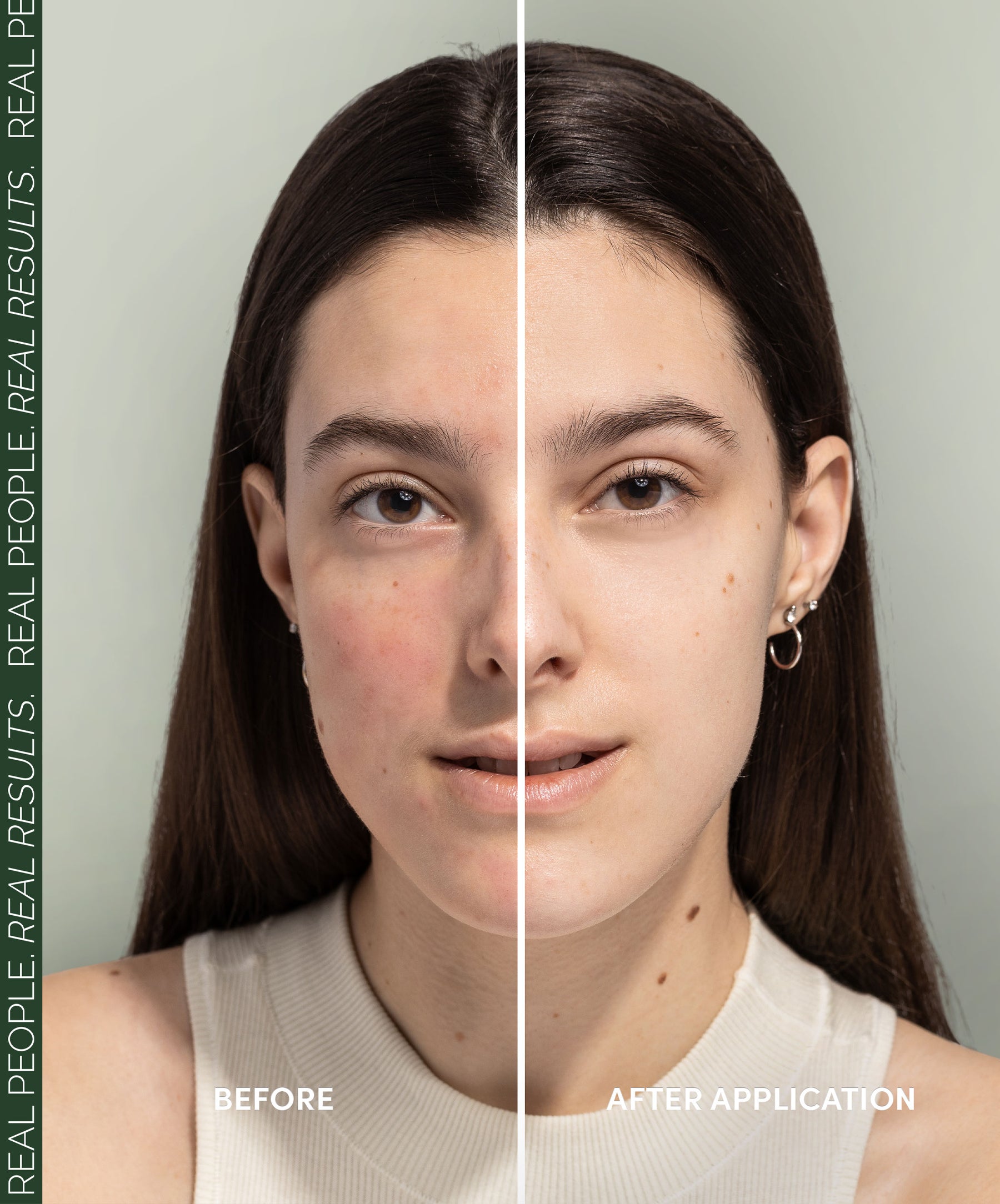 Redness Rescue Cream | Redness Reducing Moisturizer for Rosacea